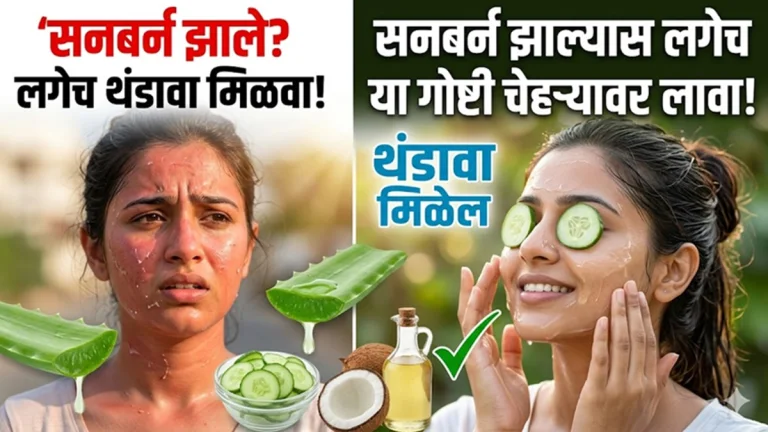 सनबर्न झाल्यास लगेच या गोष्टी चेहऱ्यावर लावा, थंडावा मिळेल - Home ...