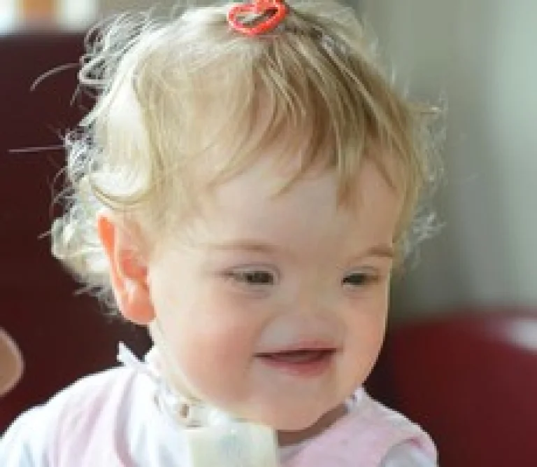 பிரிட்டனில் மூக்கு இல்லாமல் பிறந்த குழந்தை - Britain-Noseless baby ...