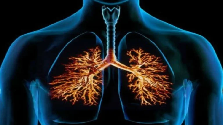 క్షయ వ్యాధి లక్షణాలు ఏమిటి? - tuberculosis symptoms | Webdunia Telugu